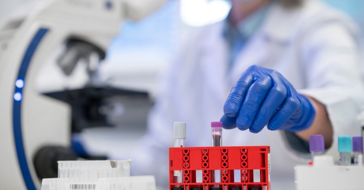 Common Tests in a Pathology Lab and What They Mean