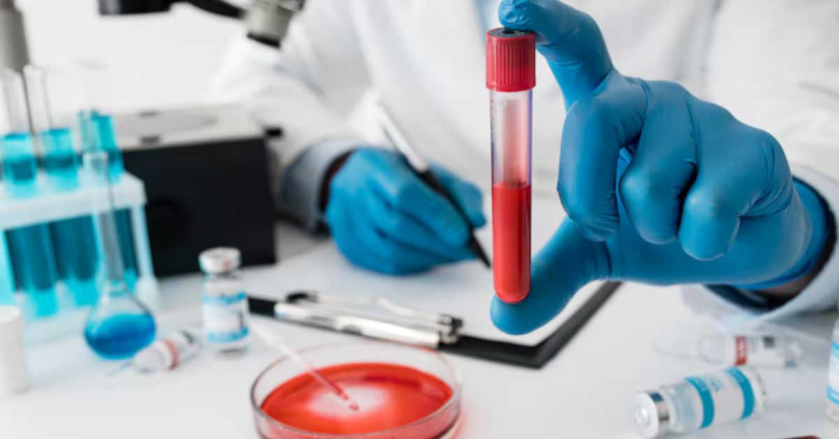 Trusted Diagnostic Experience at the Best Pathology Lab in Indore